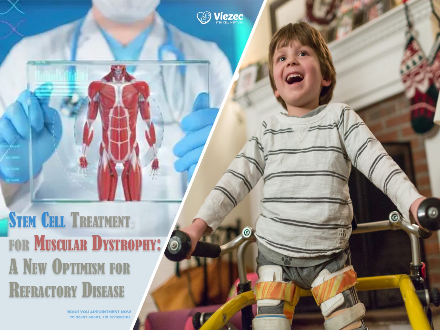 Breaking Down The Stages Of Muscular Dystrophy: What To Expect