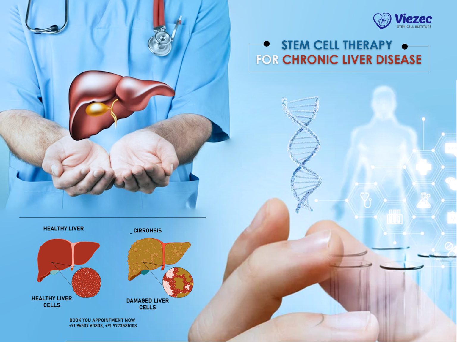 Stem Cell Therapy For Chronic Liver Disease In Delhi, India