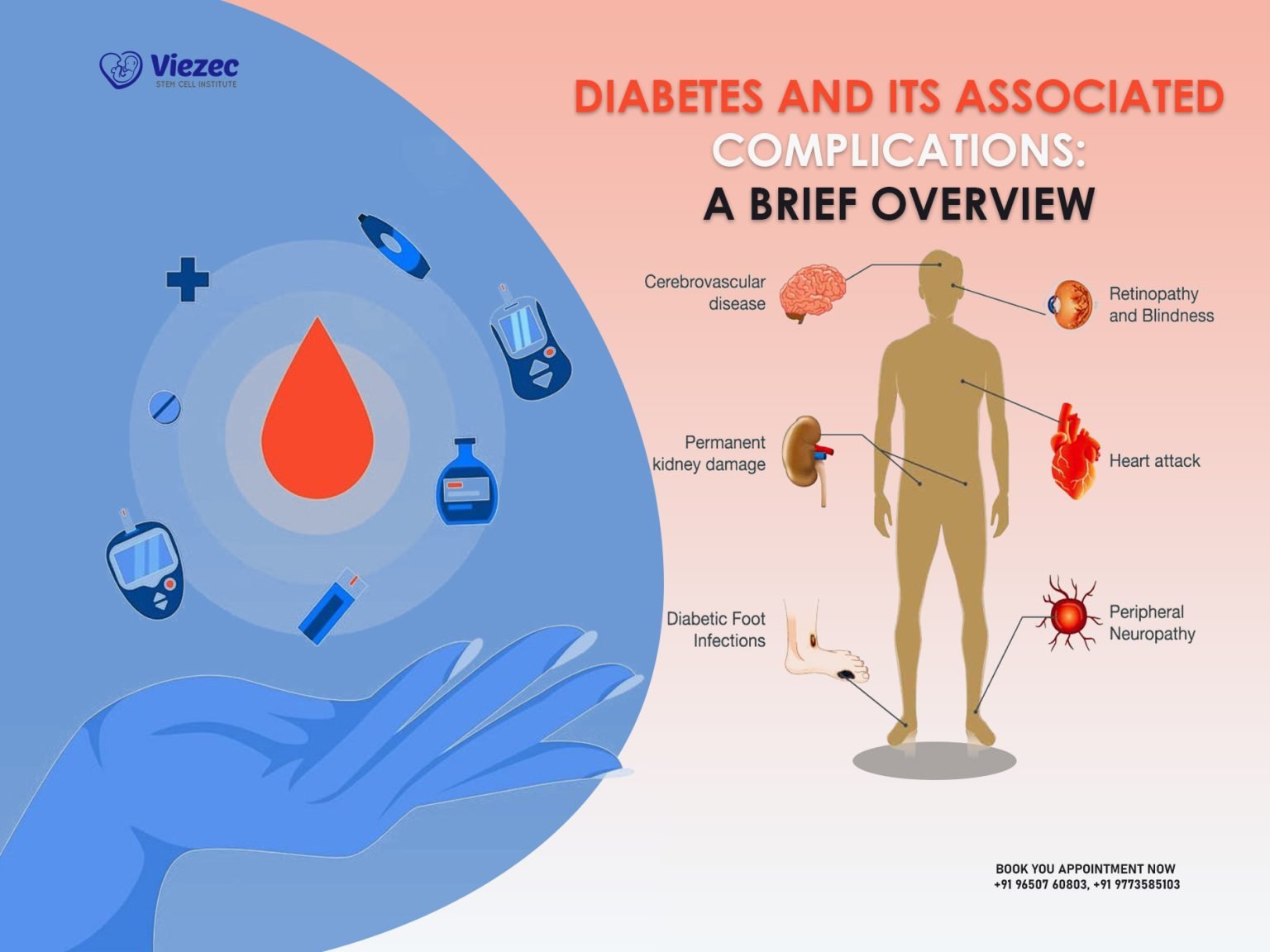 Diabetes And Its Associated Complications: A Brief Overview