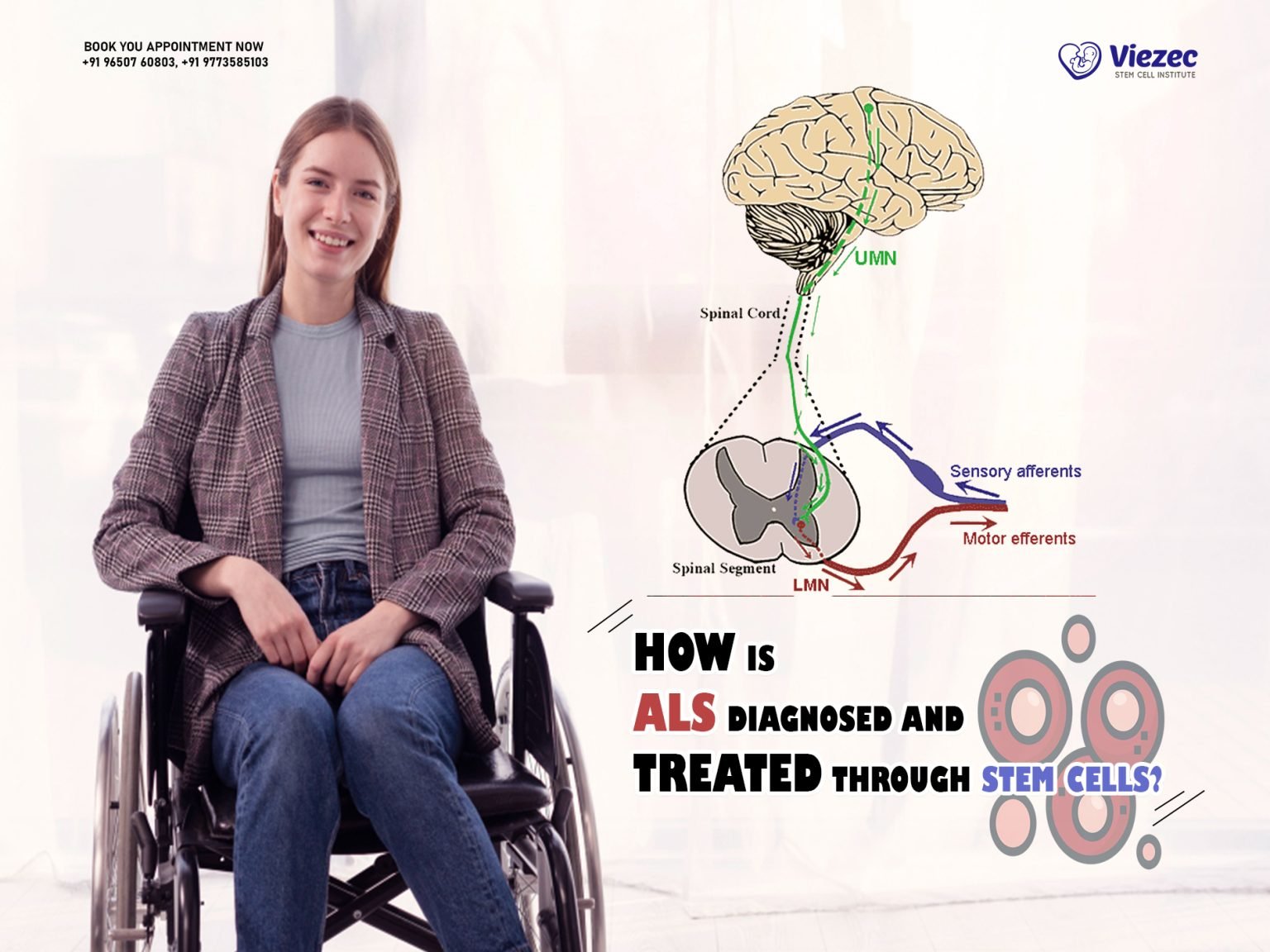 How Is ALS Diagnosed and Treated Through Stem Cells?