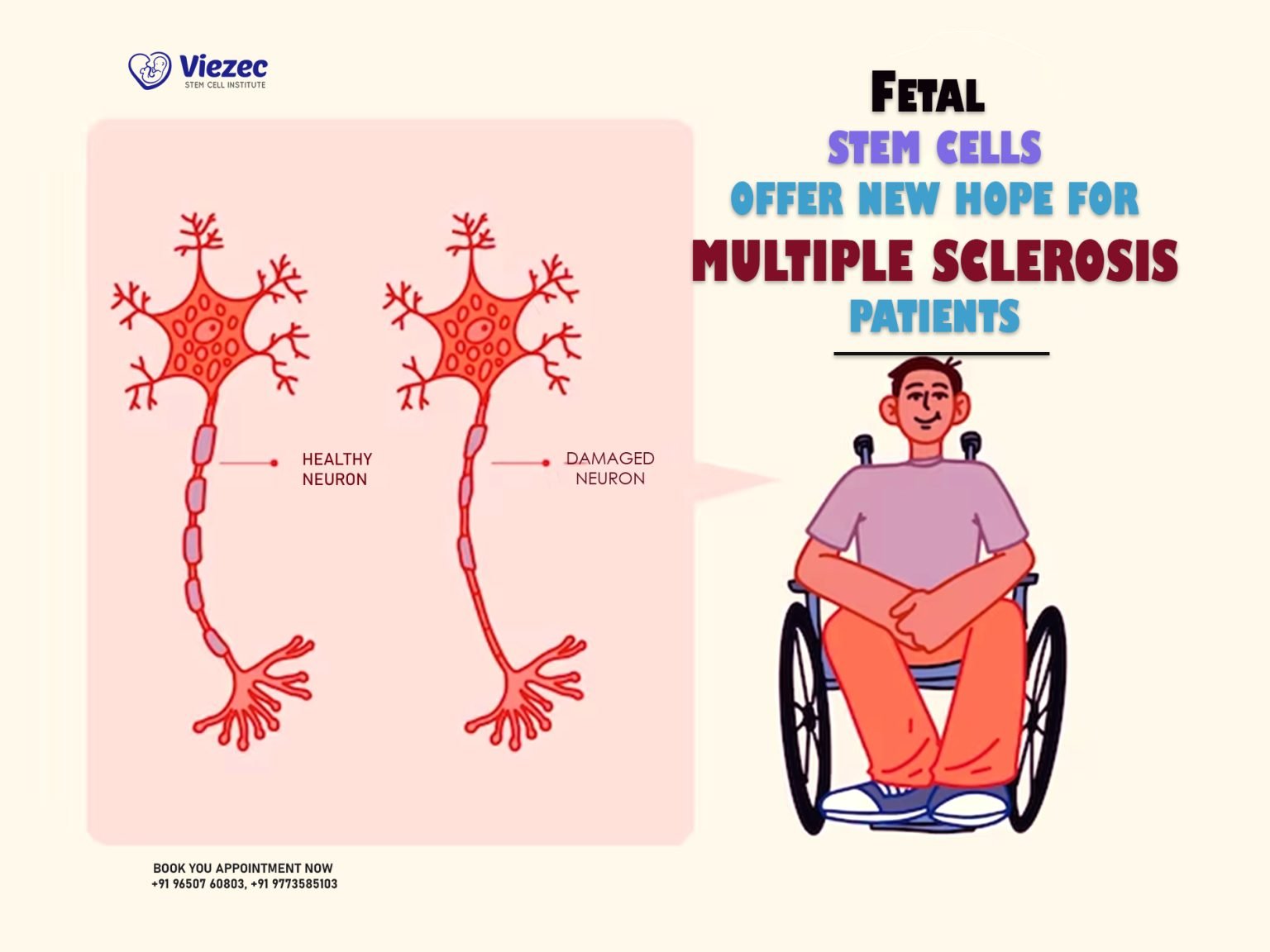 Differences Between Multiple Sclerosis And Motor Neuron Disease