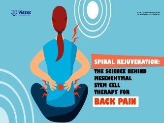 Spinal Rejuvenation: Mesenchymal Stem Cell Therapy For Back Pain