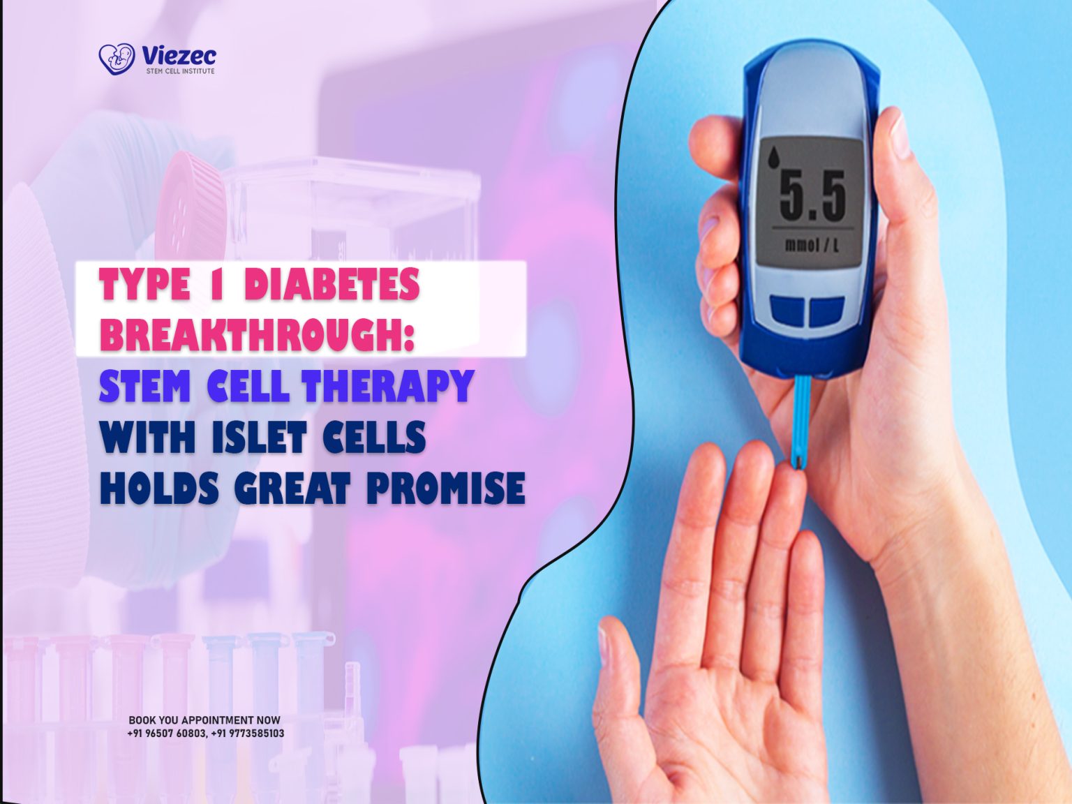 Type 1 Diabetes : Stem Cell With Islet Cells Holds Promise