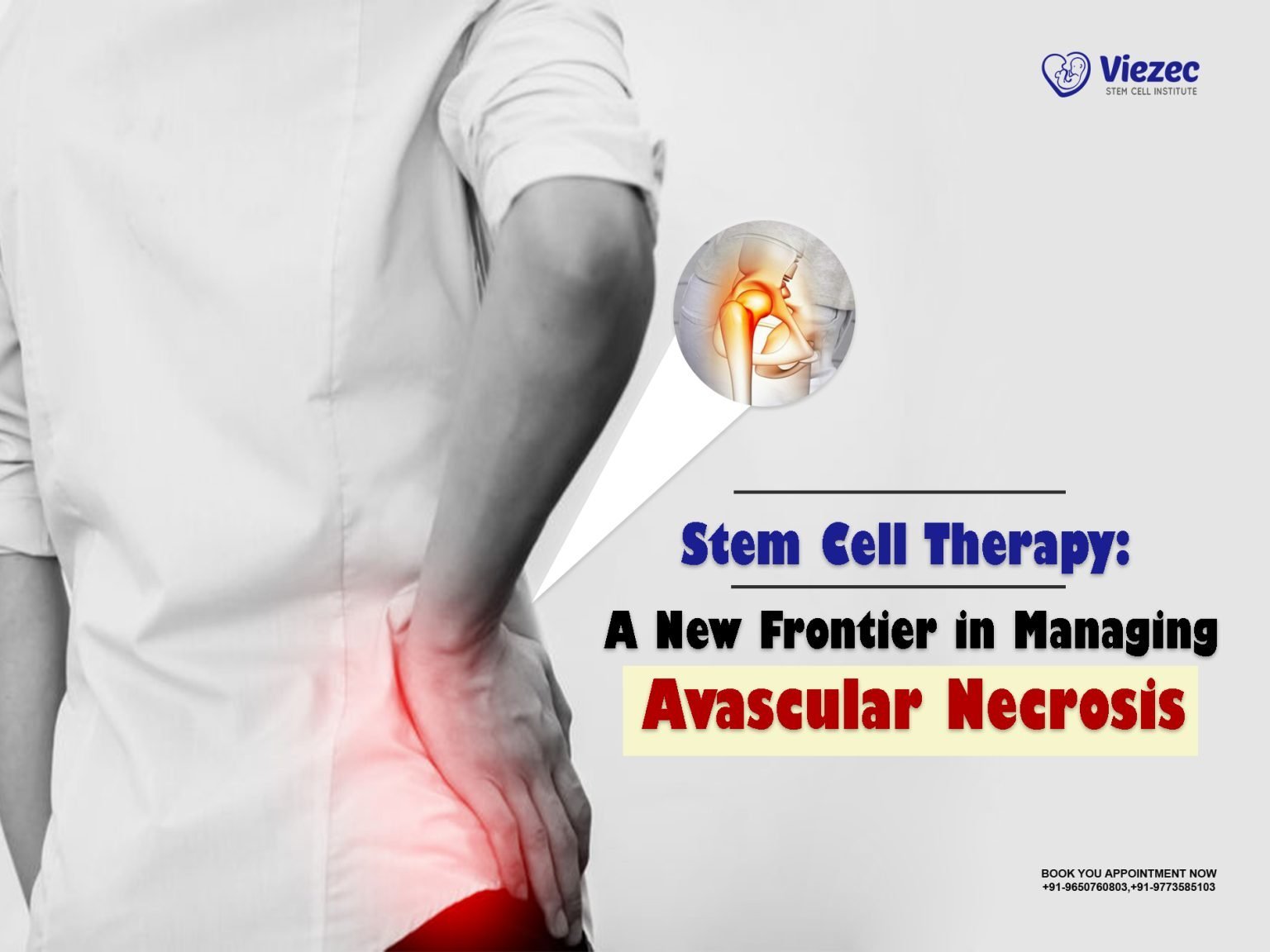 Stem Cell Therapy: New Frontier In Managing Avascular Necrosis