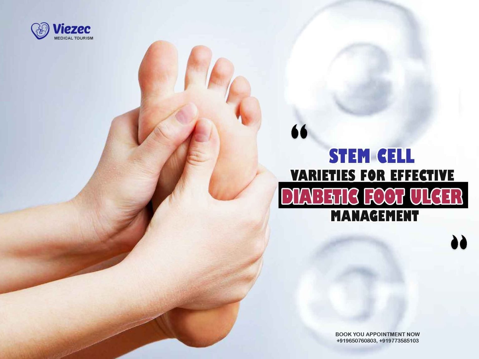 Stem Cell Varieties For Diabetic Foot Ulcer Management