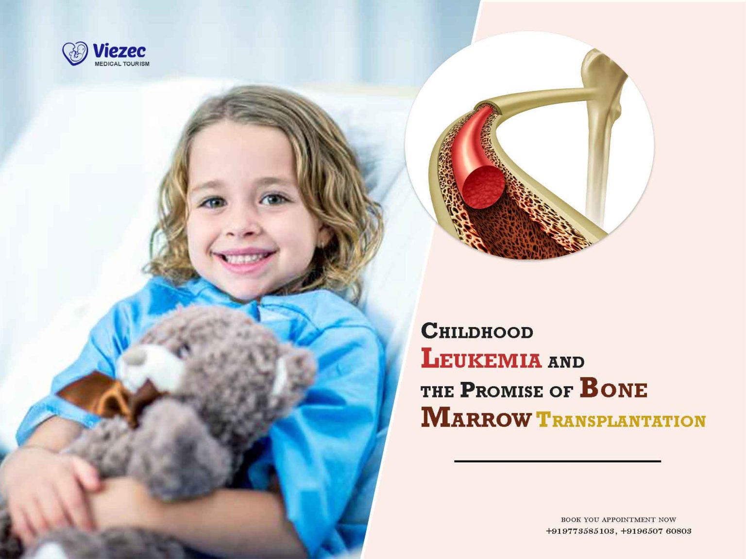 Childhood Leukemia And Promise Of Bone Marrow Transplant