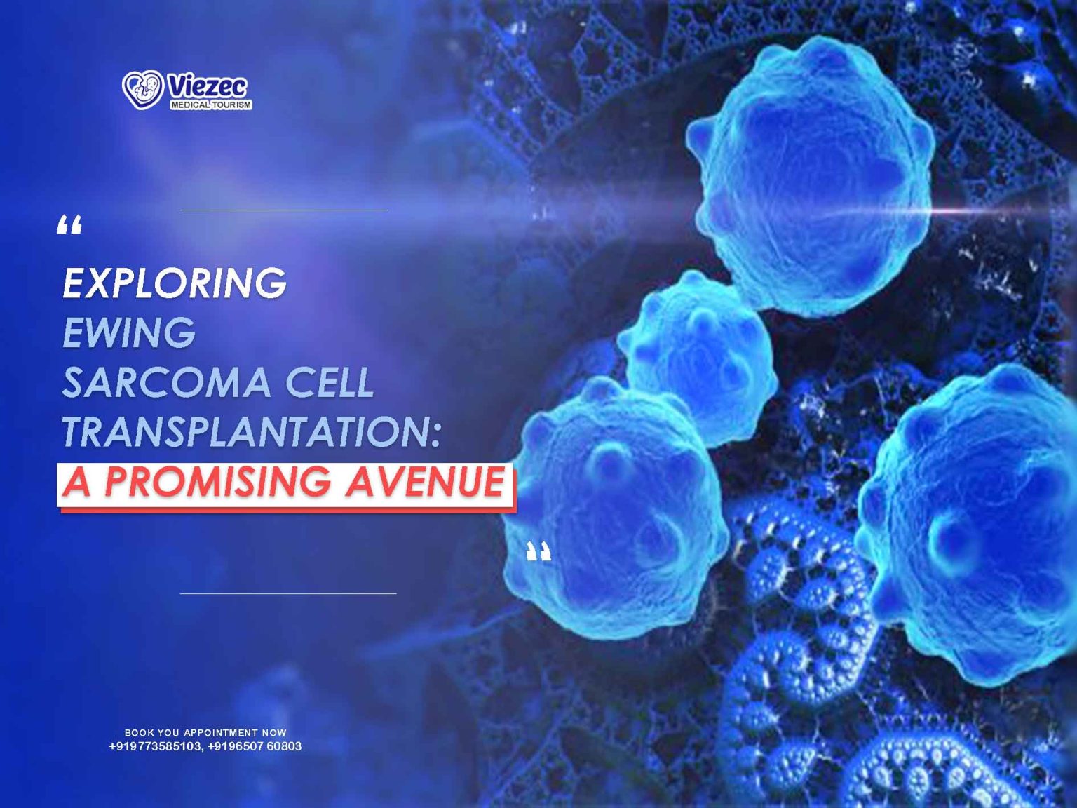 Ewing Sarcoma Stem Cell Transplantation: A Promising Avenue