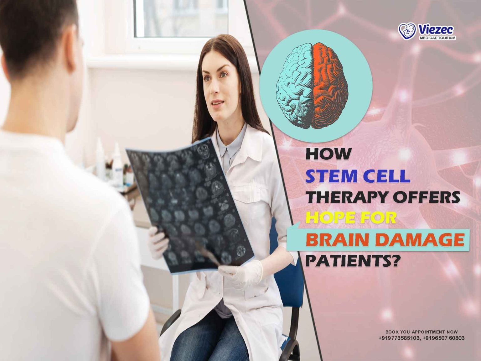 How Stem Cell Therapy Offers Hope For Brain Damage Patients