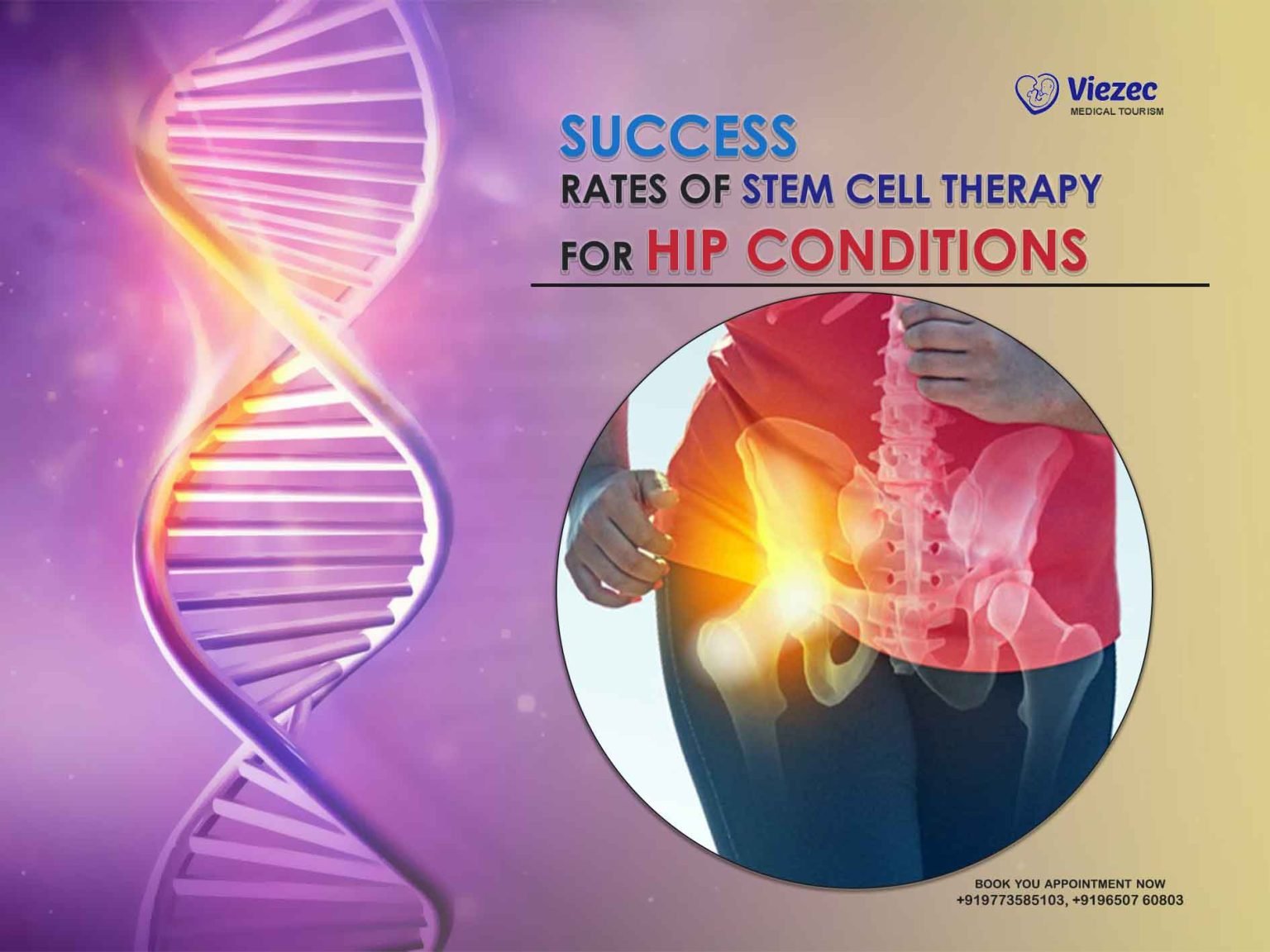 Success Rates Of Stem Cell Therapy Hip Conditions In India