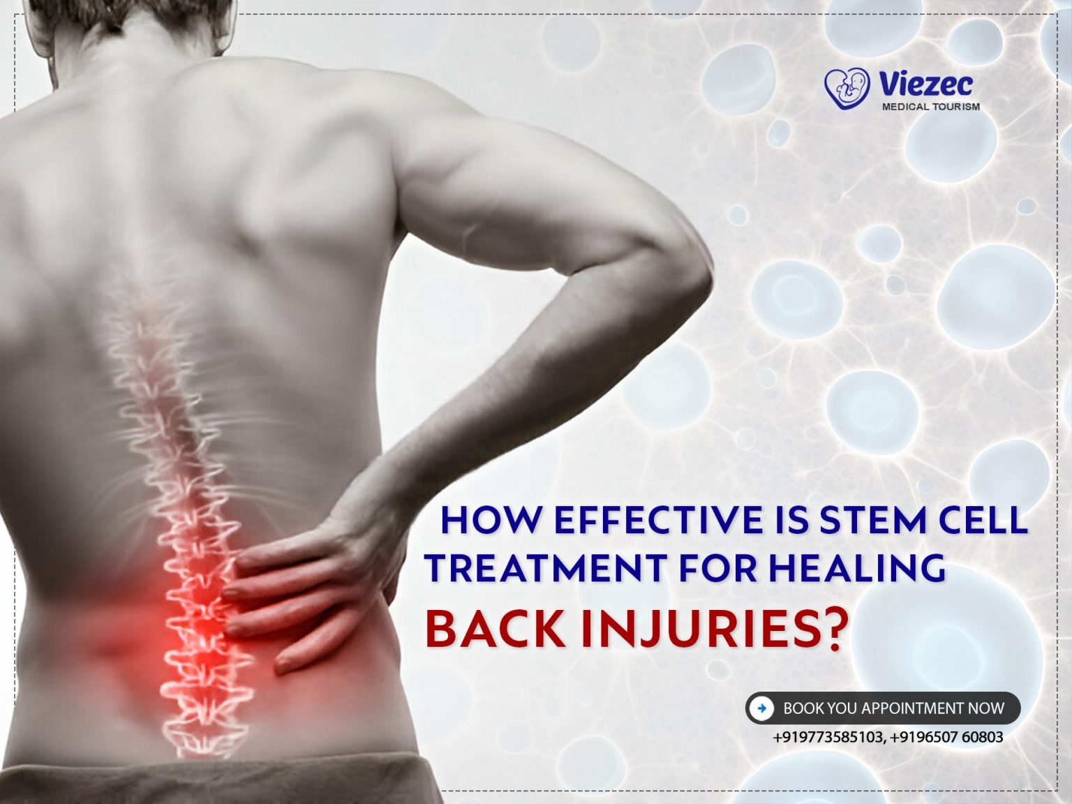 Restoring Mobility: Stem Cell Therapy For Back Injuries