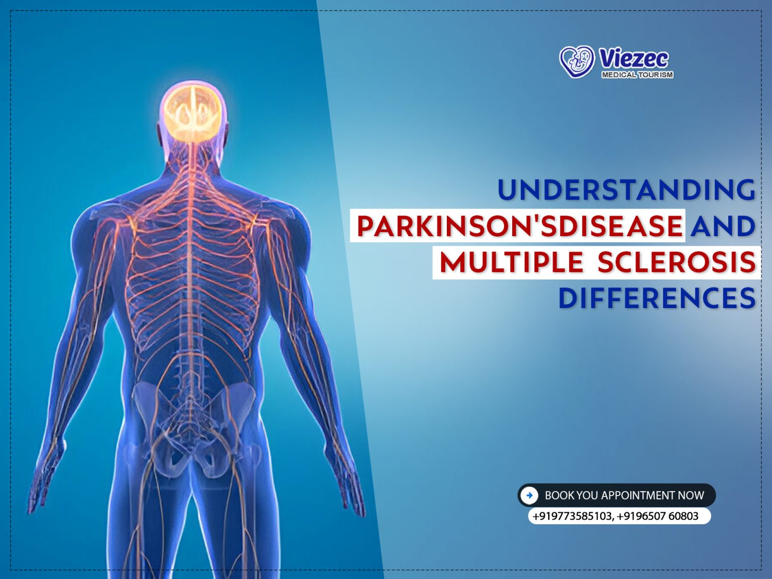 Parkinson's Disease And Multiple Sclerosis: Key Differences