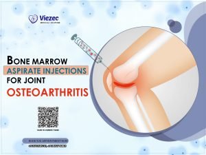 Bone Marrow Aspirate Injections For Joint Osteoarthritis