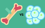 Stem Cell Vs Bone Marrow Transplant | Key Differences Explained