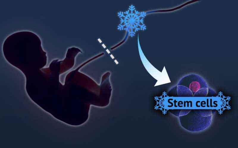 Comparing Umbilical Cord, Bone Marrow & Adipose Stem Cells